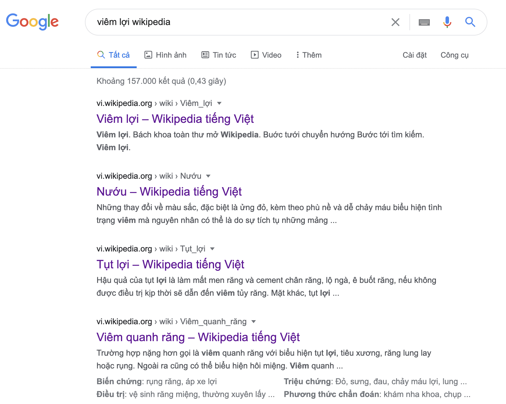 Keyword Research: Hướng dẫn nghiên cứu từ khóa A - Z (2021)